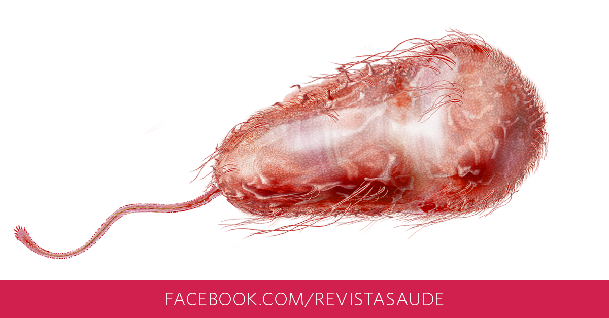 A pior epidemia de cólera da história está acontecendo agora | Veja Saúde